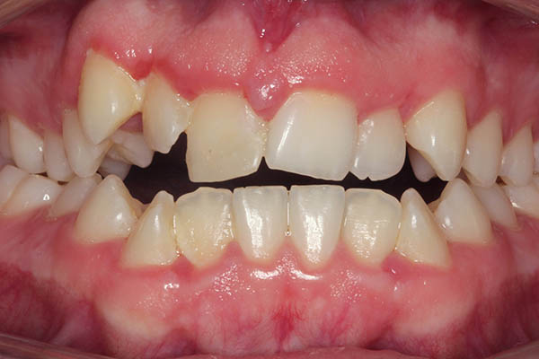 Gallery - Dr’s Rudie & Helena Swart Orthodontists/Ortodontiste