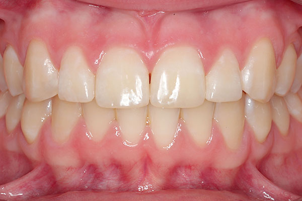 Gallery - Dr’s Rudie & Helena Swart Orthodontists/Ortodontiste