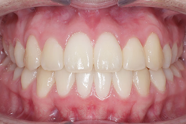 Gallery - Dr’s Rudie & Helena Swart Orthodontists/Ortodontiste